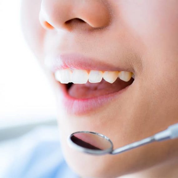 Oral DNA Testing in Miami, FL | Detect Gum Disease Early